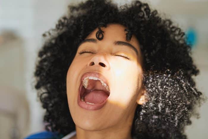 What Is a Tonsil Stone? - General Dentist in Marrero, LA